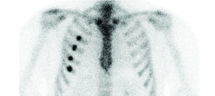 St. George - Sutherland Nuclear Medicine