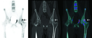 St. George - Sutherland Nuclear Medicine