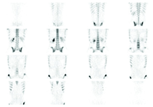 St. George - Sutherland Nuclear Medicine